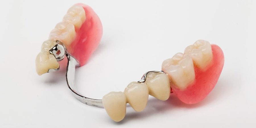 Protesi mobile - ViviSalute